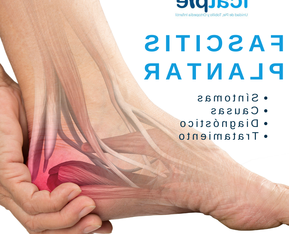 Todo lo que debes saber sobre la Plantitis: causas, síntomas y ...